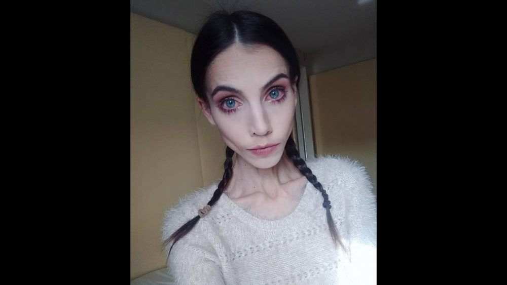 Kunst oder krank? Mager-Model Wilkomira inszeniert das eigene ...